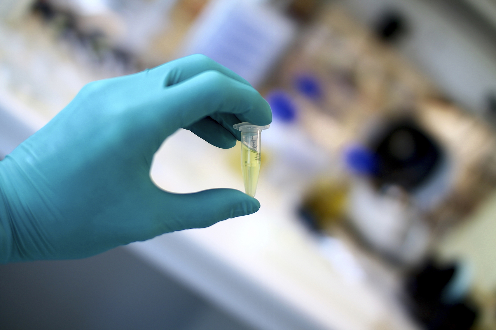 Choroby nerek – objawy, profilaktyka, diagnostyka - Pacjent ...