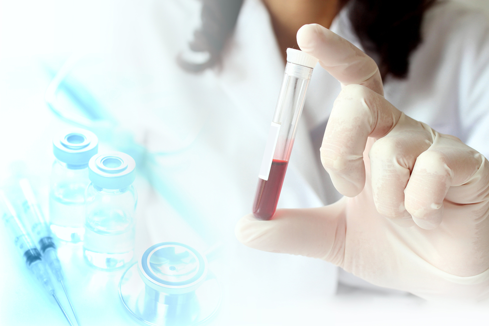 Reumatoidalne zapalenie stawów (RZS) - Pacjent - Diagnostyka ...