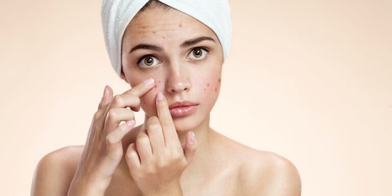 Czyrak a pryszcz - jak odróżnić? | Diag.pl