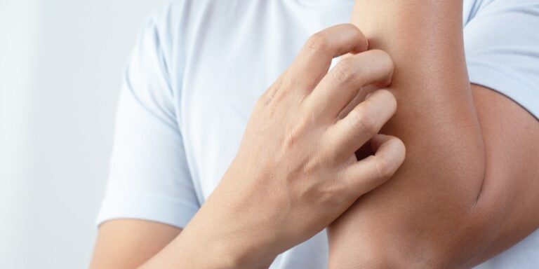 Ugryzienie pająka – jak je rozpoznać? Co robić? | Diag.pl