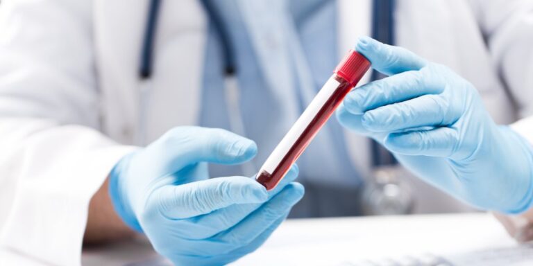 Agregacja płytek krwi - co to oznacza? | Diag.pl