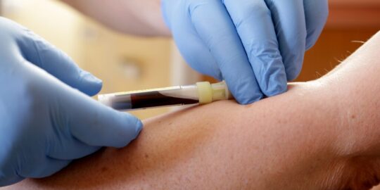 Czym są i jaką rolę w organizmie pełnią leukocyty? I Diag.pl